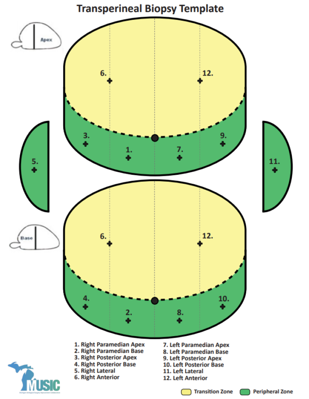 Transperineal Biopsy Tips and Tricks | Koelis Academy