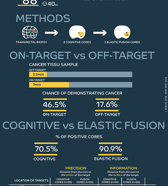 Precision matters in MR Imaging-targeted prostate biopsies Cornud et al ...