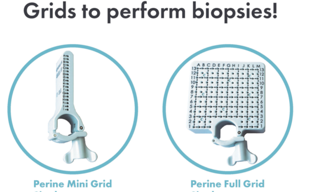 Distributor Training Replay | KOELIS Academy