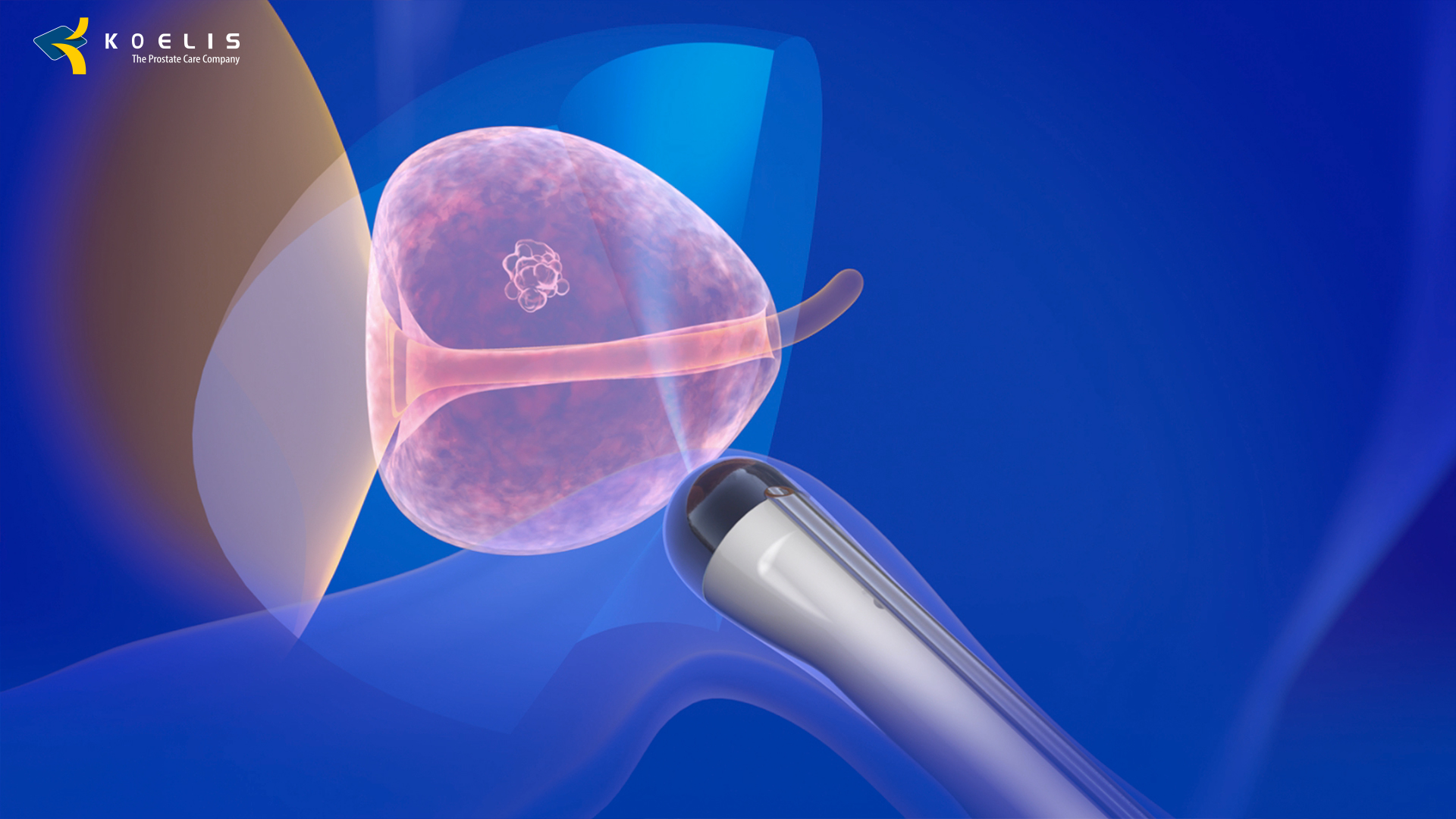 KOELIS Image Library | Koelis Academy