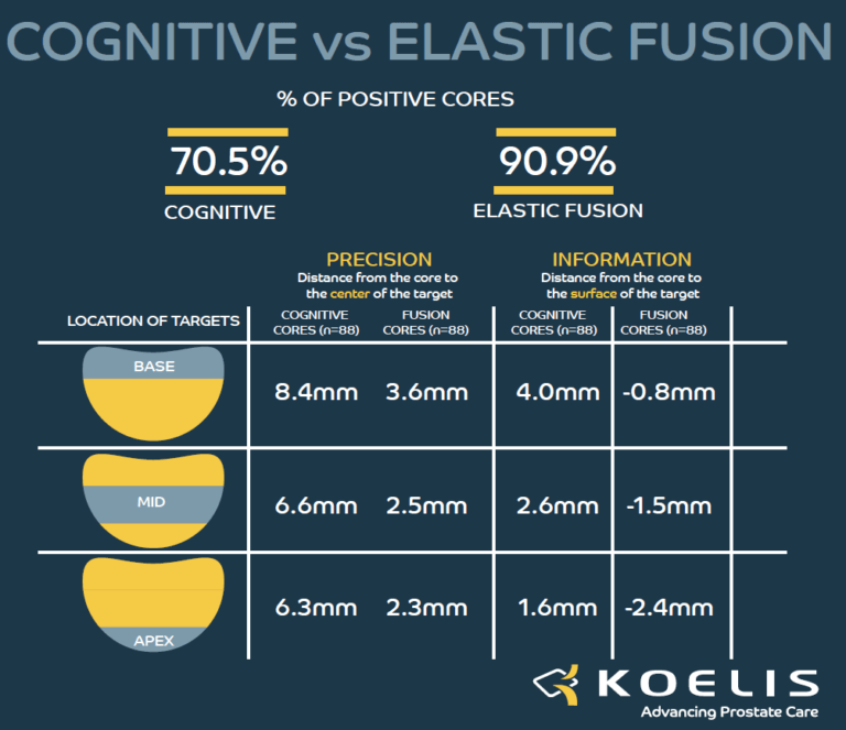 MRI / Ultrasound Fusion Guided Prostate Biopsy | KOELIS