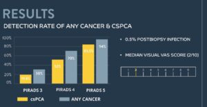 Transperineal Biopsy for Prostate Cancer Detection | KOELIS