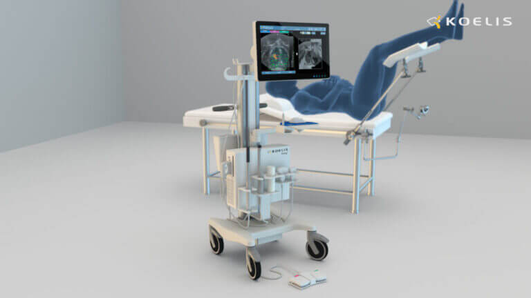 Transperineal Biopsy for Prostate Cancer Detection | KOELIS