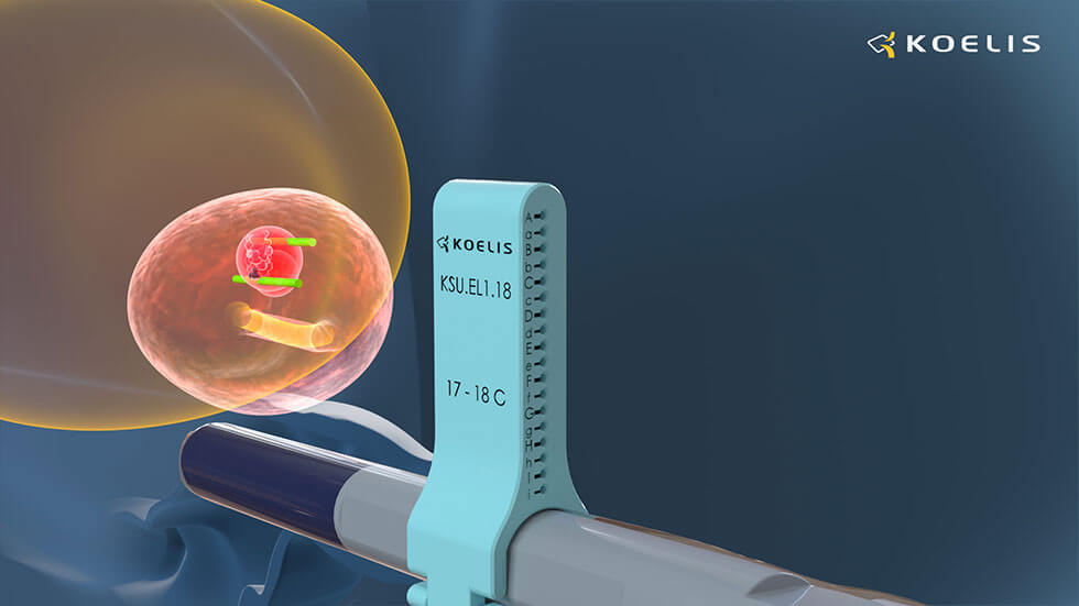 Transperineal Biopsy For Prostate Cancer Detection KOELIS Transperineal Biopsy For Prostate Cancer Detection KOELIS