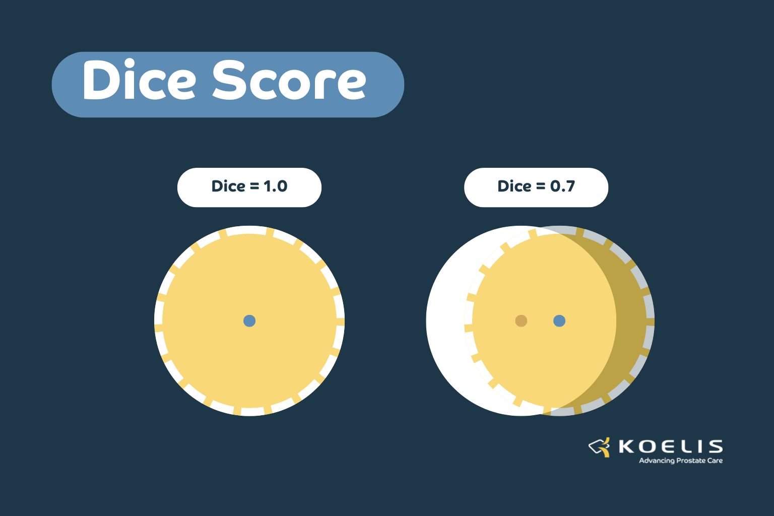Dice Score explained for medical image segmentation