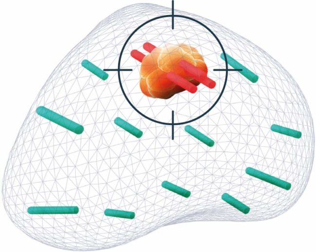 KOELIS Trinity® MRI-Ultrasound Fusion Biopsy System