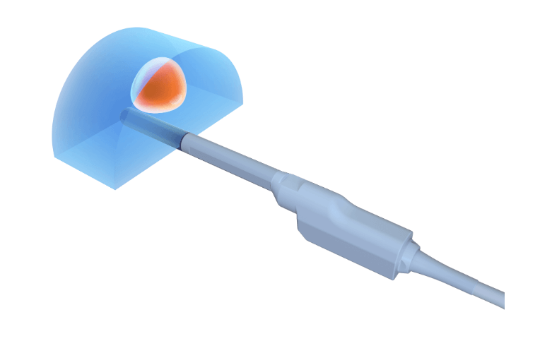 Ultrasound Probes & Transducers