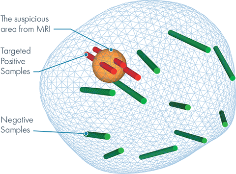 KOELIS Trinity® MRI-Ultrasound Fusion Biopsy System