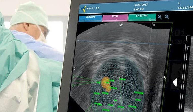 Prostate Ultrasound: Procedure, Biopsy & Risks