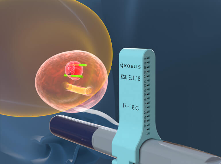 Transperineal Biopsy for Prostate Cancer Detection | KOELIS