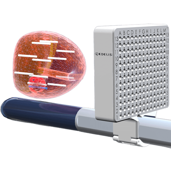 ProMap Focal Therapy | KOELIS
